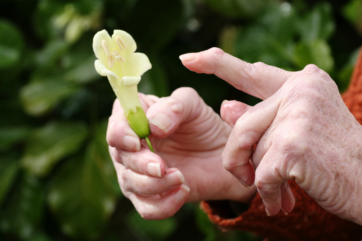 Rheumatoid Nodules What You Need To Know The Arthritis Connection